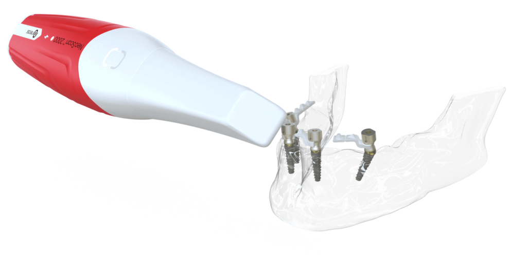 Neoss - Intelligent Simplicity