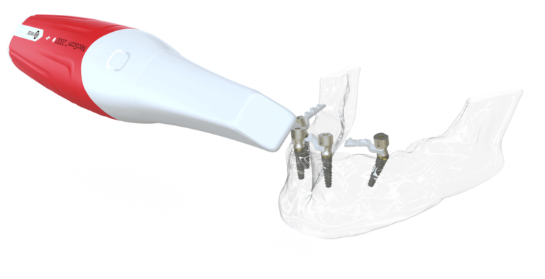 Neoss - Intelligent Simplicity