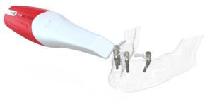 Neoss - Intelligent Simplicity